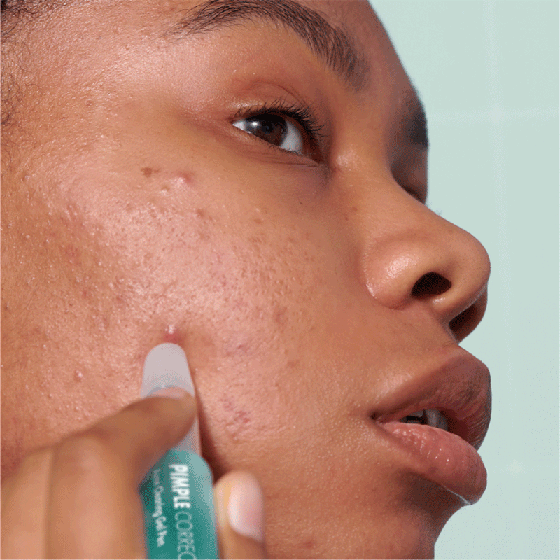 Pimple Patrol Duo | Hero Cosmetics