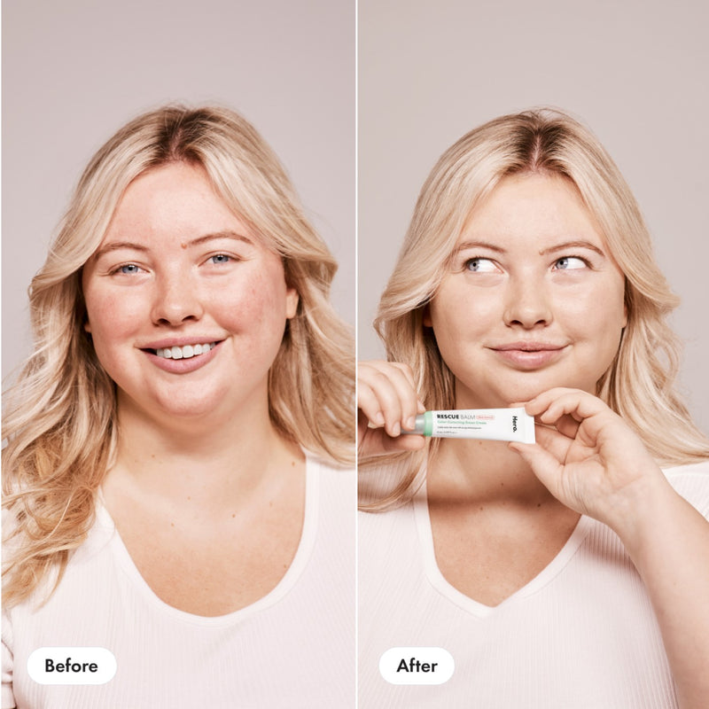 Rescue Balm +Red Correct | 15 ml | Hero Cosmetics