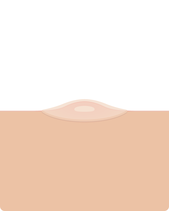 Mighty Patch Original | Hero Cosmetics