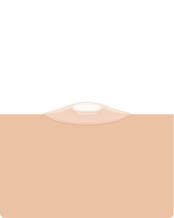 Mighty Patch Original | Hero Cosmetics