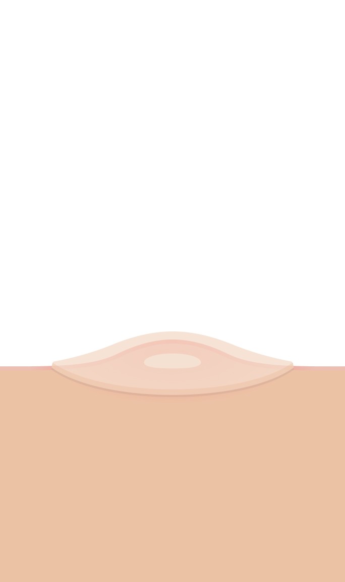 Mighty Patch Original | Hero Cosmetics